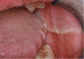Identification and Diagnosis of Occlusal Disease | SDS Occlusion Blog
